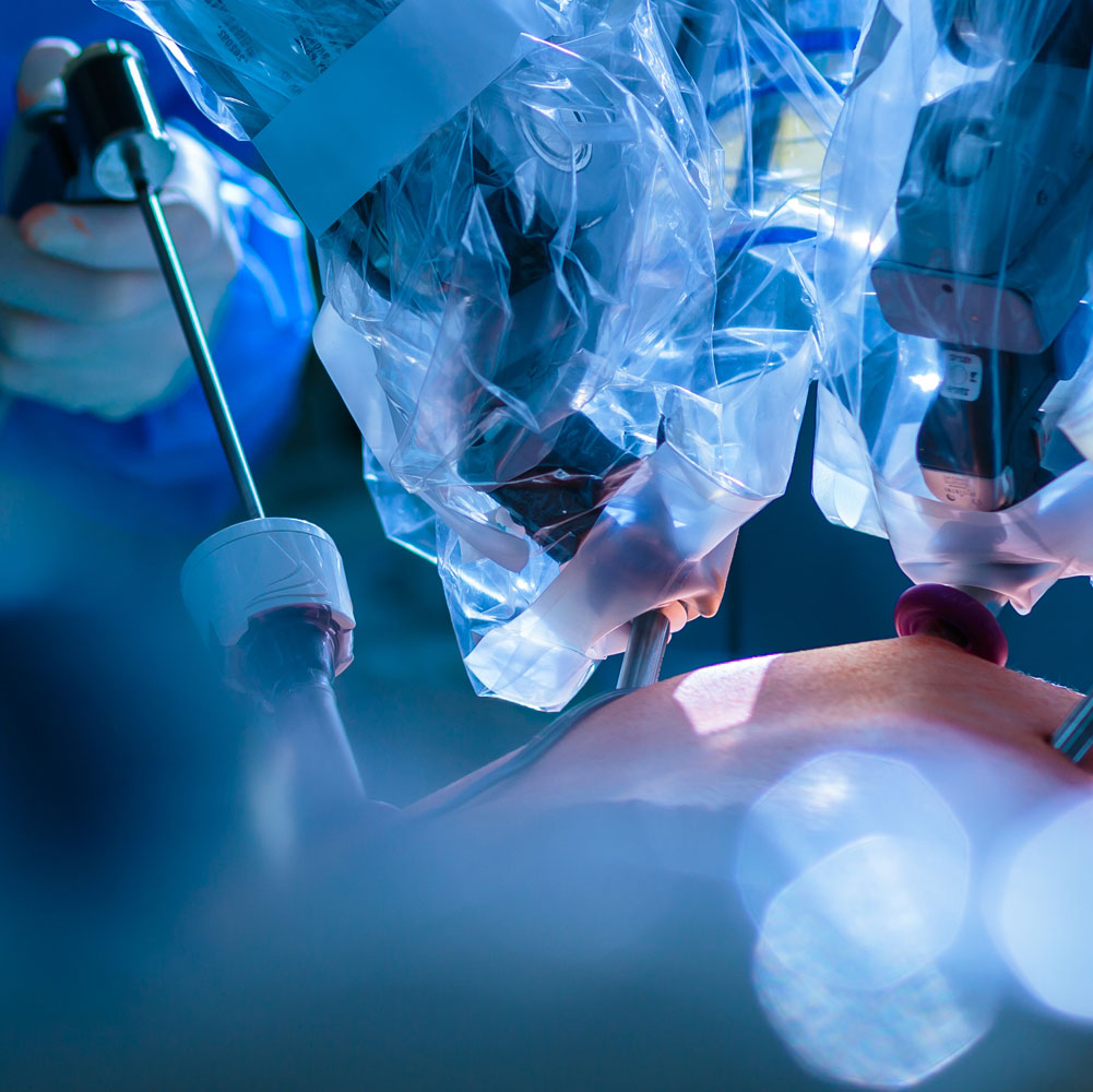 Advance Surgical – Your source for specialist assistants in Robotic Surgery